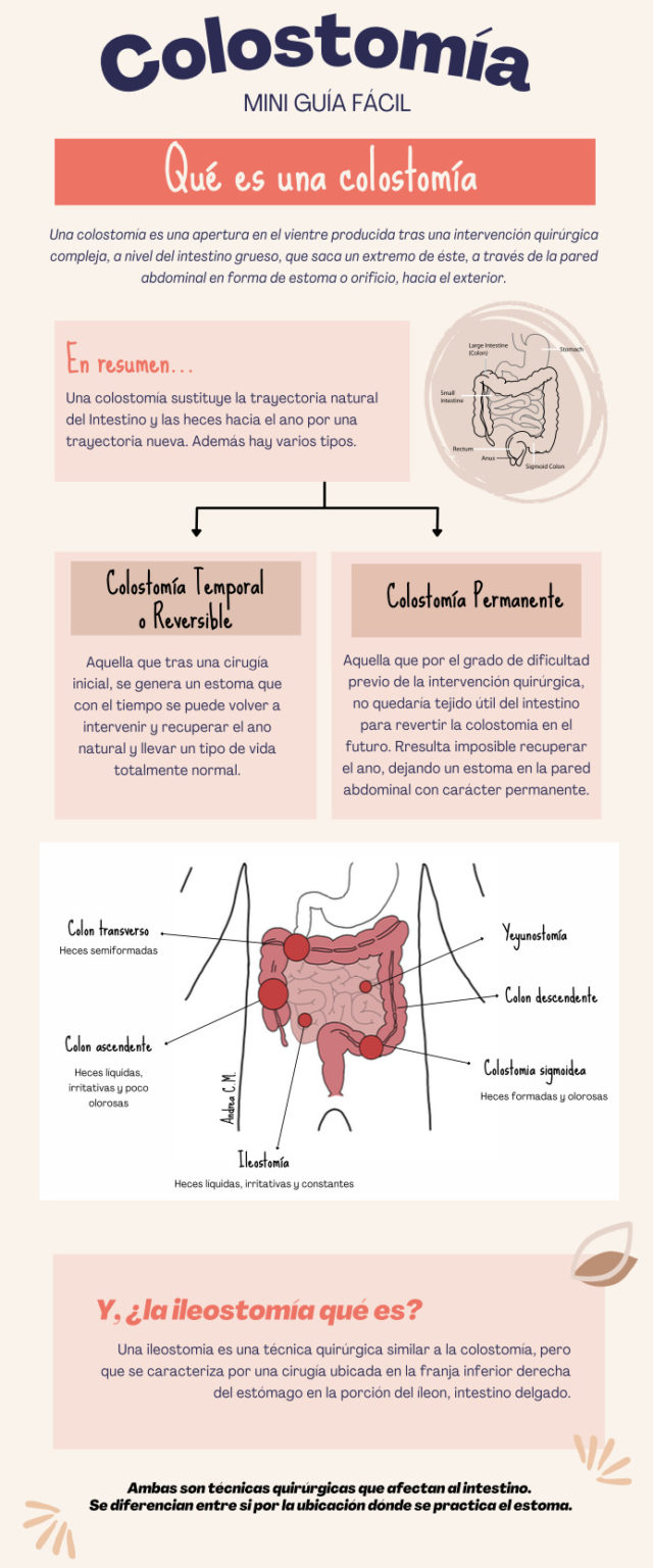 Colostomía: Todo lo Que Necesitas Saber [Guía, Paso a paso] - Enfermera ...